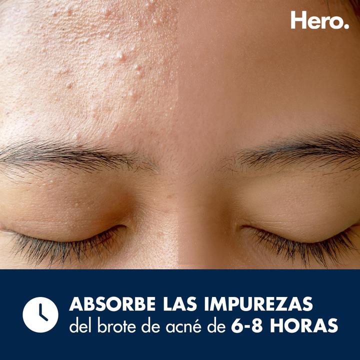 Hero Hero Mighty Patch Duo 12pz Hero Mighty Patch - H-E-B México